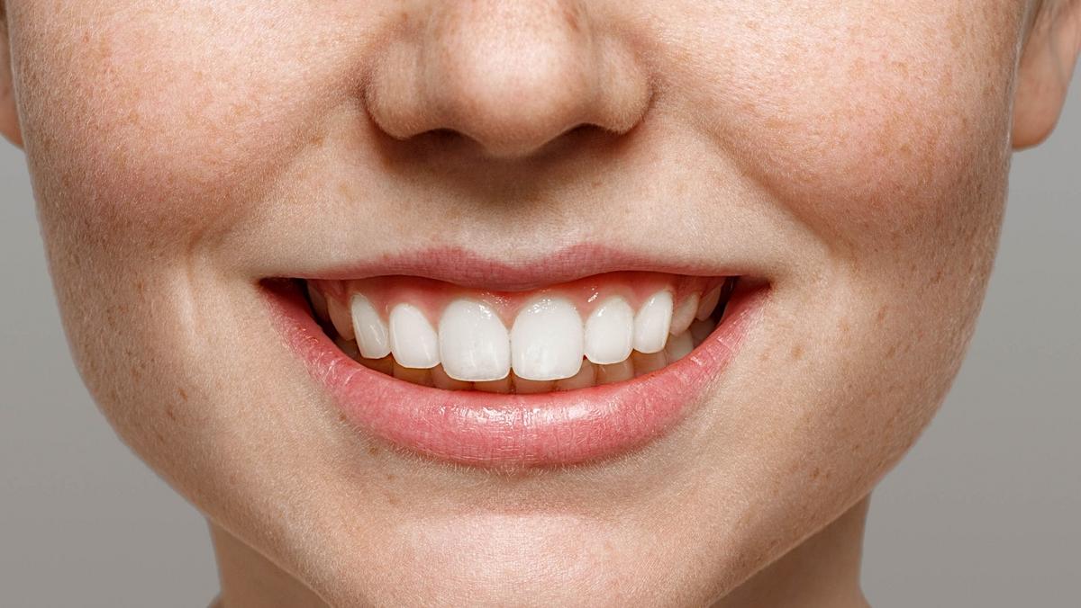 5 Conseils Utiles Pour Préserver la Blancheur de vos Dents | Cosmetic ...